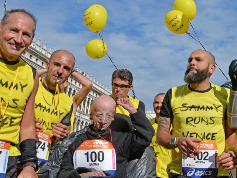 Sammy Basso, chi era il 28enne malato di progeria: la malattia, la ...