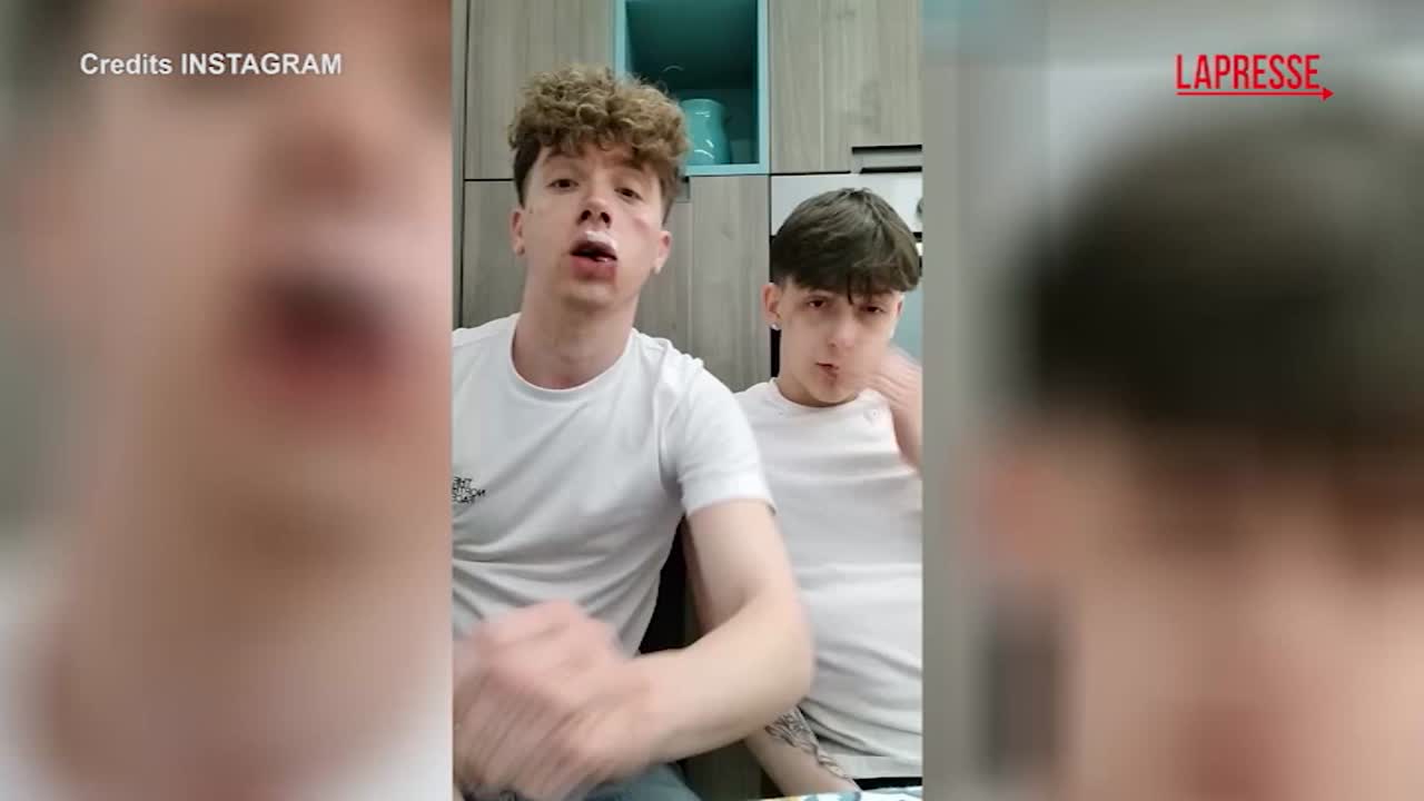 VIDEO Capodanno, modello di OnlyFans picchiato a Torino - LaPresse